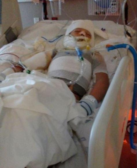 10-Year-Old Boy on Life Support After a Bully Set Him Alight - Stay at ...
